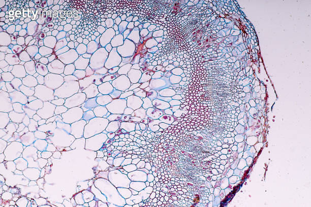Zygomycota, or zygote fungi ,Downy mildew of cruzifers host tissue with ...