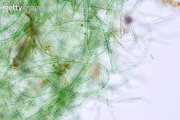 Anabaena is a genus of filamentous cyanobacteria on slide under the ...