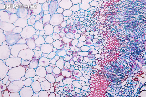 Zygomycota, or zygote fungi ,Downy mildew of cruzifers host tissue with ...