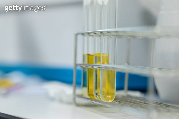 Sample analysis using Spectrophotometer for lab experiments. 이미지 ...