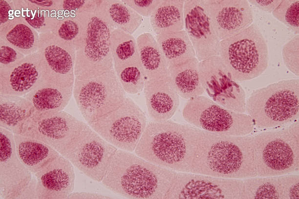 Root tip of Onion and Mitosis cell in the Root tip of Onion under a ...