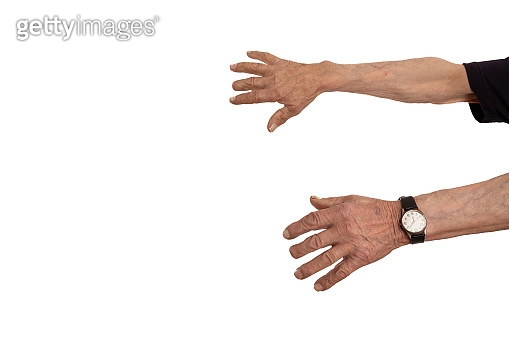 Hands of an old man with a missing middle finger phalanx on the white ...