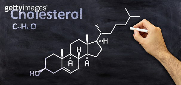 Cholesterol structural chemical formula, chalk drawing on a blackboard ...