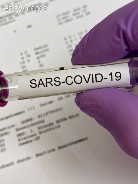 Sars-Covid-19 lab papers 이미지 (1209345576) - 게티이미지뱅크