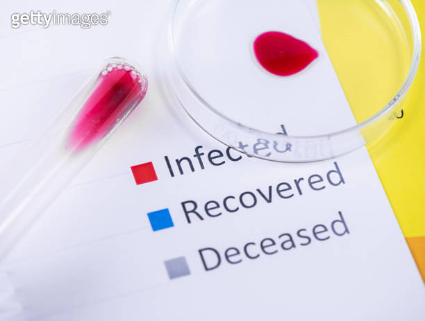 Blood tests related to corona virus infection 이미지 (1212391926) - 게티이미지뱅크