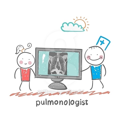 Pulmonologist Chest X Ray Shows A Patient 이미지 A10750745 게티이미지뱅크
