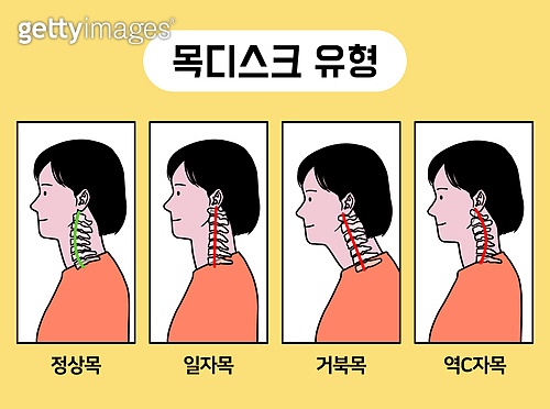 목디스크, 건강관리, 질병 (건강이상), 사람목 (주요신체부분), 사람뼈 (Body Part), 거북목증후군 (질병) 이미지 ...