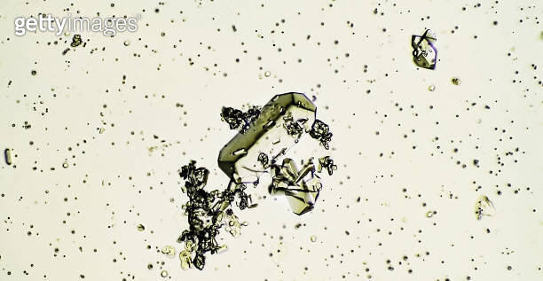 Struvite crystals in pet Urine under a microscope (1311131009) - 게티이미지뱅크