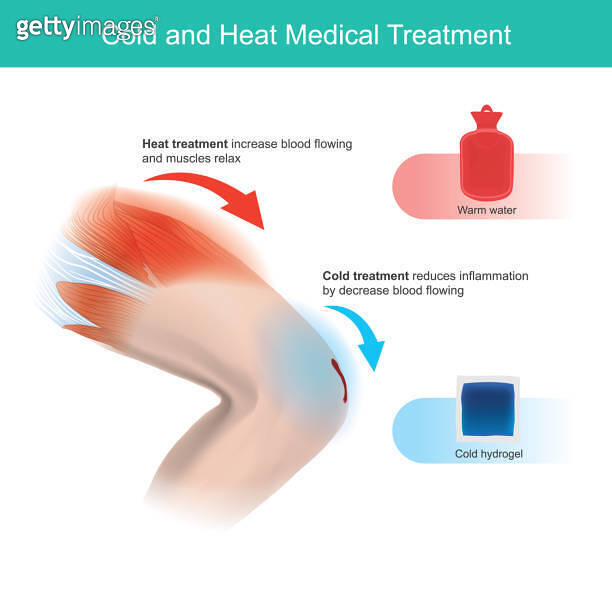 Cold and Heat Medical Treatment. This graphic explain human leg 2 ...