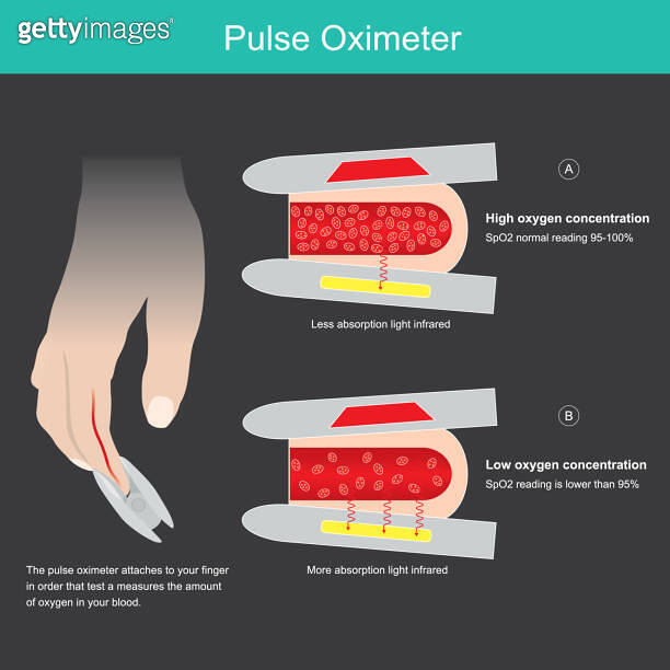 Pulse Oximeter. Illustration. (1334298123) 일러스트, 무료 일러스트 - 게티이미지뱅크