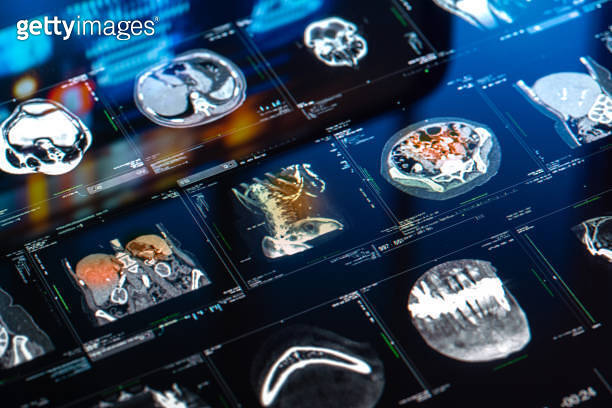 Modern Medical MRI Screen 이미지 (1321295958) - 게티이미지뱅크