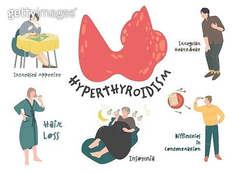 Hyperthyroidism symptoms, thyroid gland disease. Hyperthyreosis signs ...