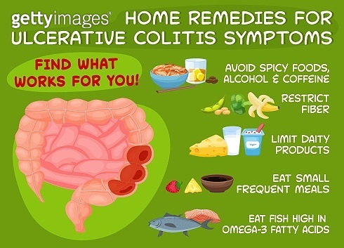 Home remedies for ulcerative colitis, medical poster. Diet advice for ...
