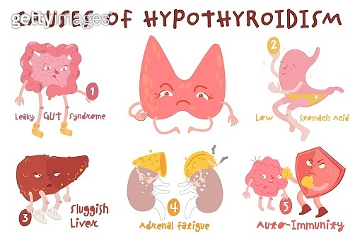 Causes of hypothyroidism thyroid gland disease. Endocrine system ...