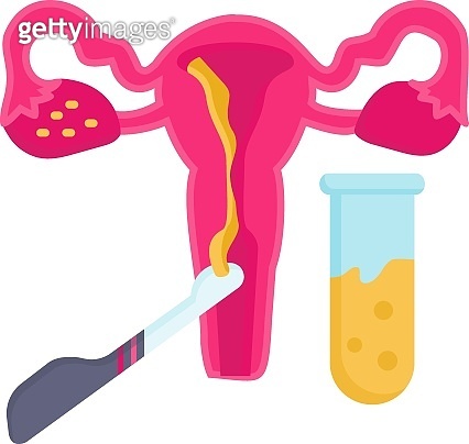 Transvaginal oocyte retrieval Concept, IVF TVOR Vector color Icon ...