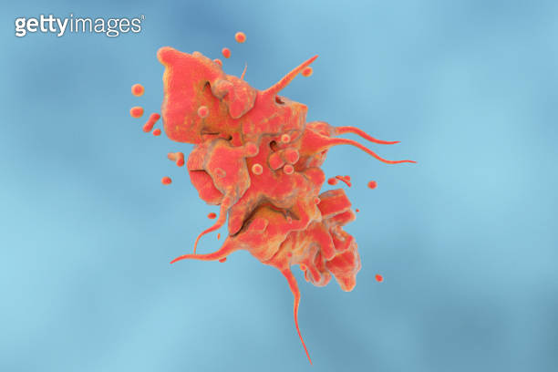 Destroyed Cancer Cell by T-Cell 이미지 (1323659738) - 게티이미지뱅크