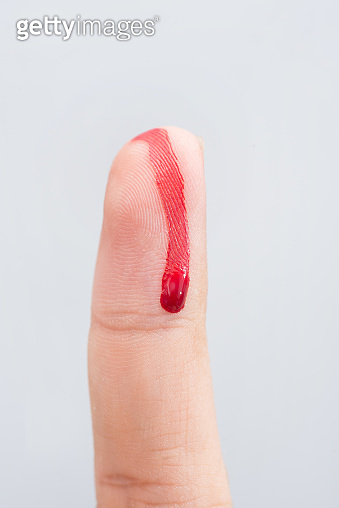 Bleeding blood from the cut finger wound. Injured finger with bleeding ...