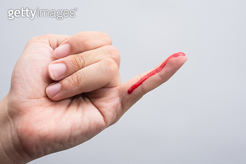 Bleeding blood from the cut finger wound. Injured finger with bleeding ...