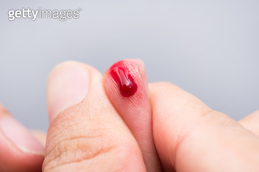 Bleeding blood from the cut finger wound. Injured finger with bleeding ...
