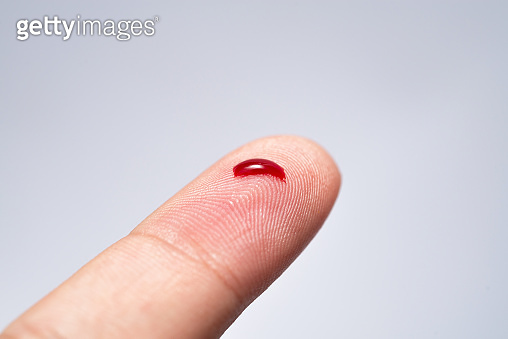 Bleeding blood from the cut finger wound. Injured finger with bleeding ...