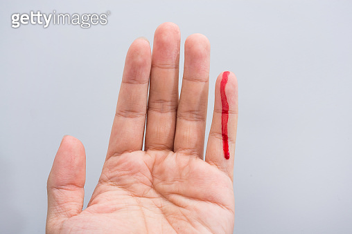 Bleeding blood from the cut finger wound. Injured finger with bleeding ...