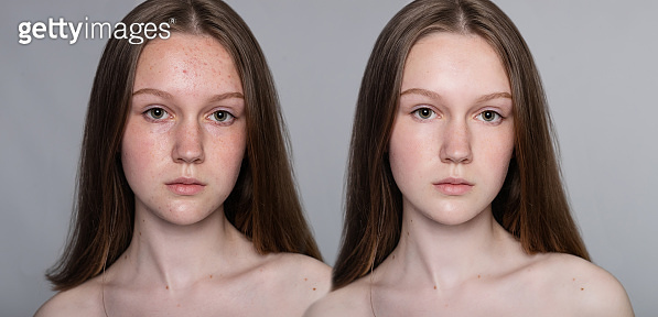 Before and after cosmetic operation. Young pretty woman portrait 이미지 ...