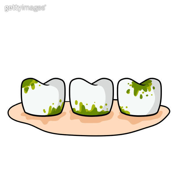 Caries and dental problems. Dentistry and sick dirty teeth with stains ...