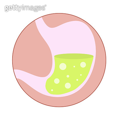 Human stomach. Internal organ of body. Bubbles in acid. X-ray of belly ...