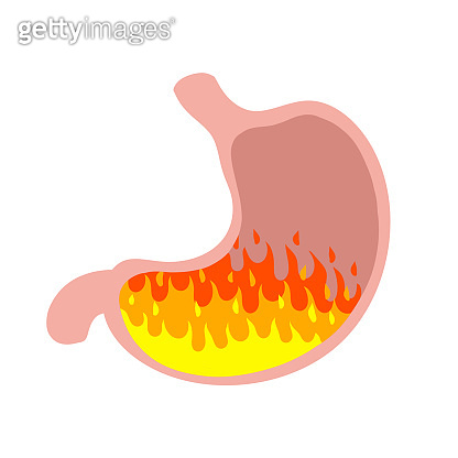 Digestive problems. Heartburn in stomach. Medical care. Indigestion in ...