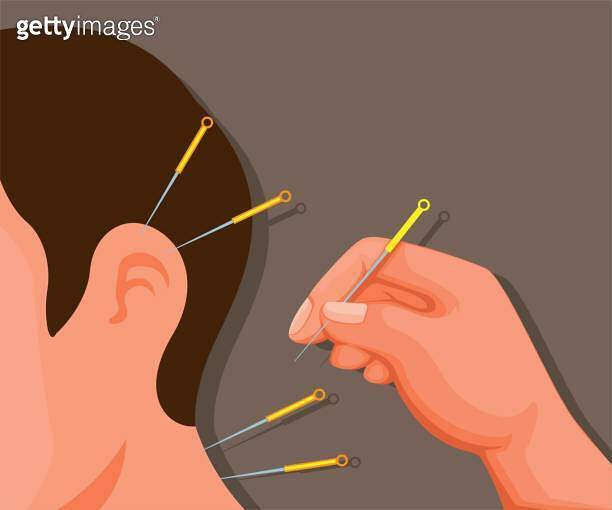 Chinese traditional acupuncture cartoon illustration vector (1347257390 ...