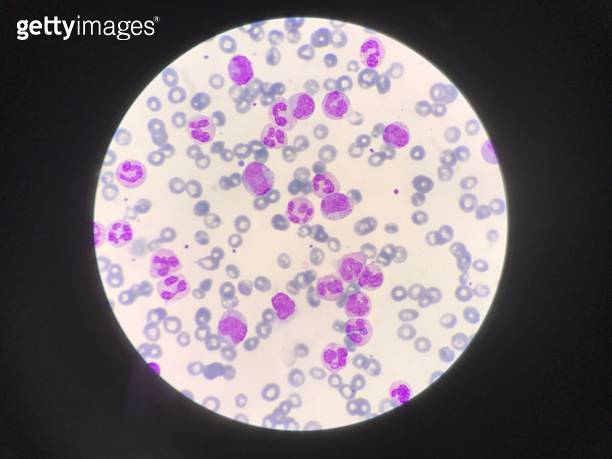 Immature and mature white blood cells.Segmented neutrophil,blast cells ...