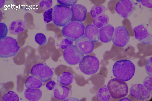Immature and mature white blood cells.Segmented neutrophil,blast cells ...