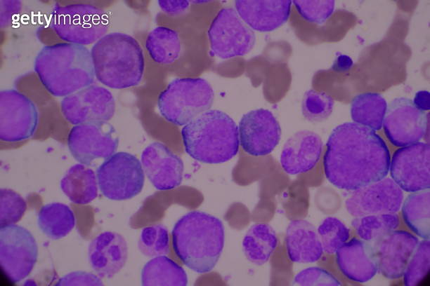 Immature and mature white blood cells.Segmented neutrophil,blast cells ...