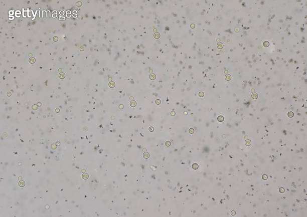 Cryptococcus neoformans is an encapsulated fungal organism and it can ...