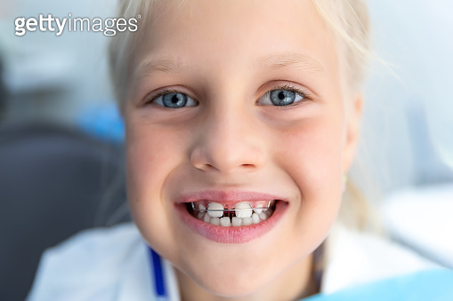Little blond happy kid girl at dentist office smiling showing diastema ...