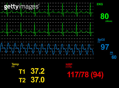Patient Monitoring Vital Signs. EKG, Pulse Oximetry, Temperature and ...