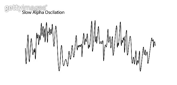 EEG (electroencephalography) Slow Alpha Oscilation pattern 이미지 ...