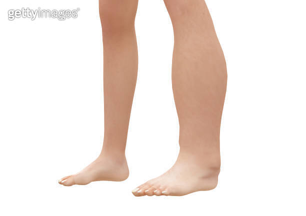 Peripheral edema is swelling of the legs, foot and ankle due to the ...