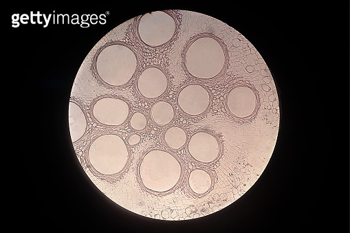 Cross sections of the plant root under microscope view. 이미지 (1302865460 ...