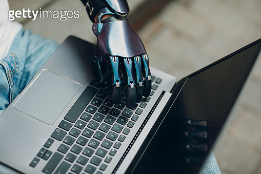 Young disabled man with artificial prosthetic hand using typing on ...