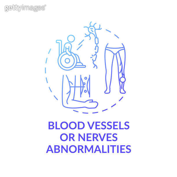 Blood vessels and nerves abnormalities concept icon (1314514948) 일러스트 ...