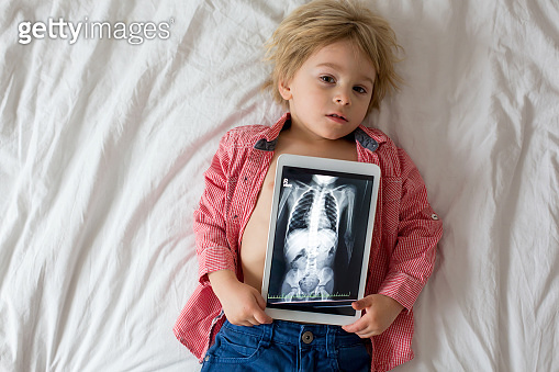 Toddler child, holding x-ray picture on tablet of child body with ...