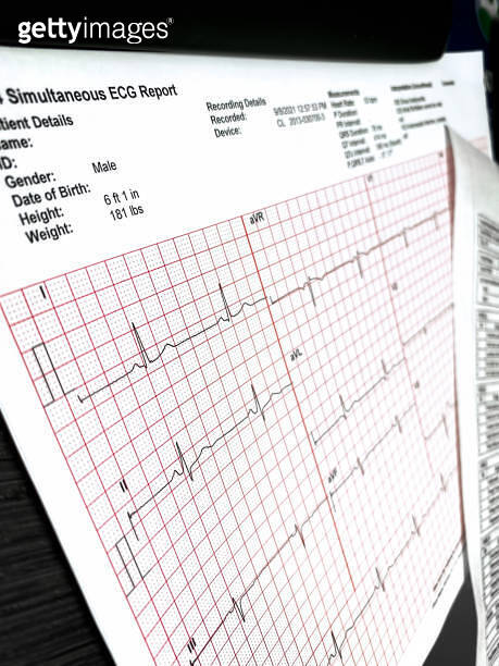 Ecg report 이미지 (1356517410) - 게티이미지뱅크