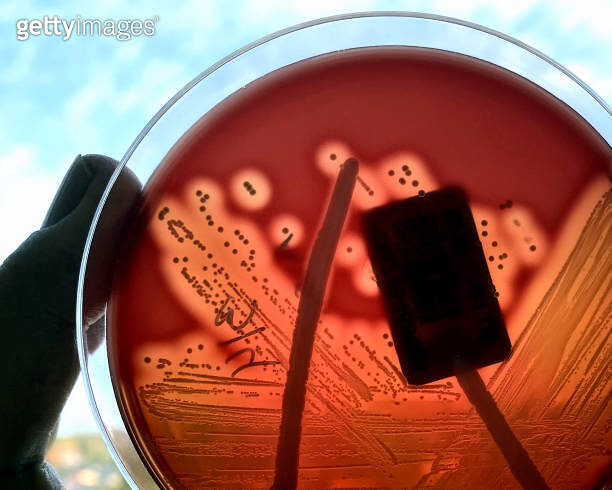 Streptococcus pyogenes (Group A streptococci) 이미지 (1315881073) - 게티이미지뱅크