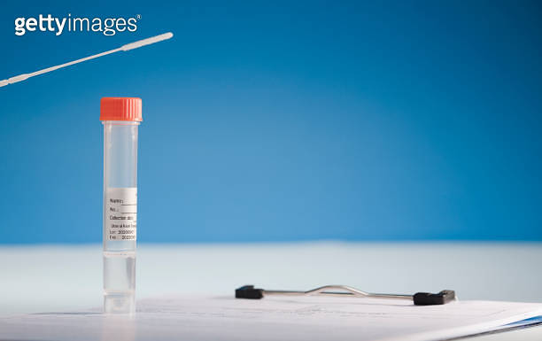 Swab for nasopharyngeal smear, and transport transparent vial and ...