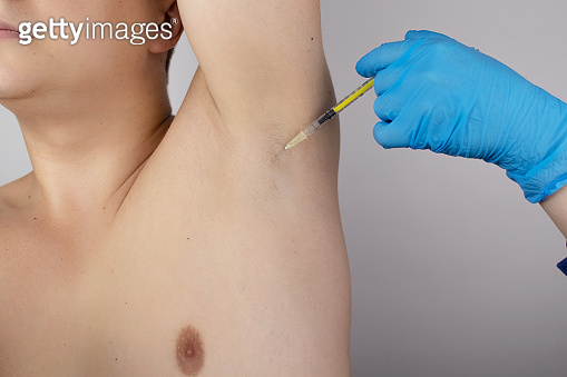 Man receiving botox injection in armpit as treatment of hyperhidrosis ...
