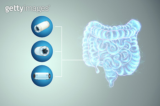 Holographic projection of intestinal scan and capsule endoskom with ...