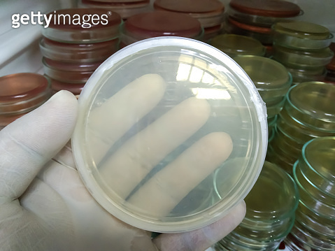 906 Skin scraping specimen for fungal culture and sensitivity test ...