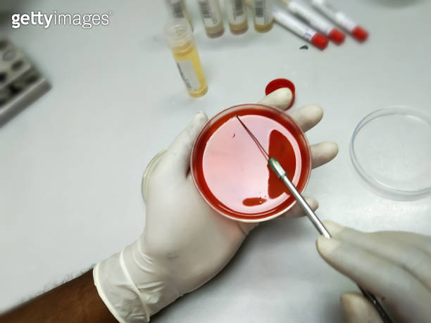 Microbiologist inoculation urine sample on Blood agar medium and ...