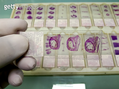Histological Hematoxylin and eosin stained microscopic slides. Isolated ...